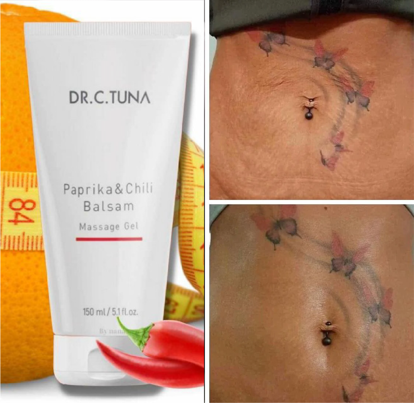 DR. C. TUNA – Gel de Masaje Bálsamo de Paprika & Chili – Libélula ...